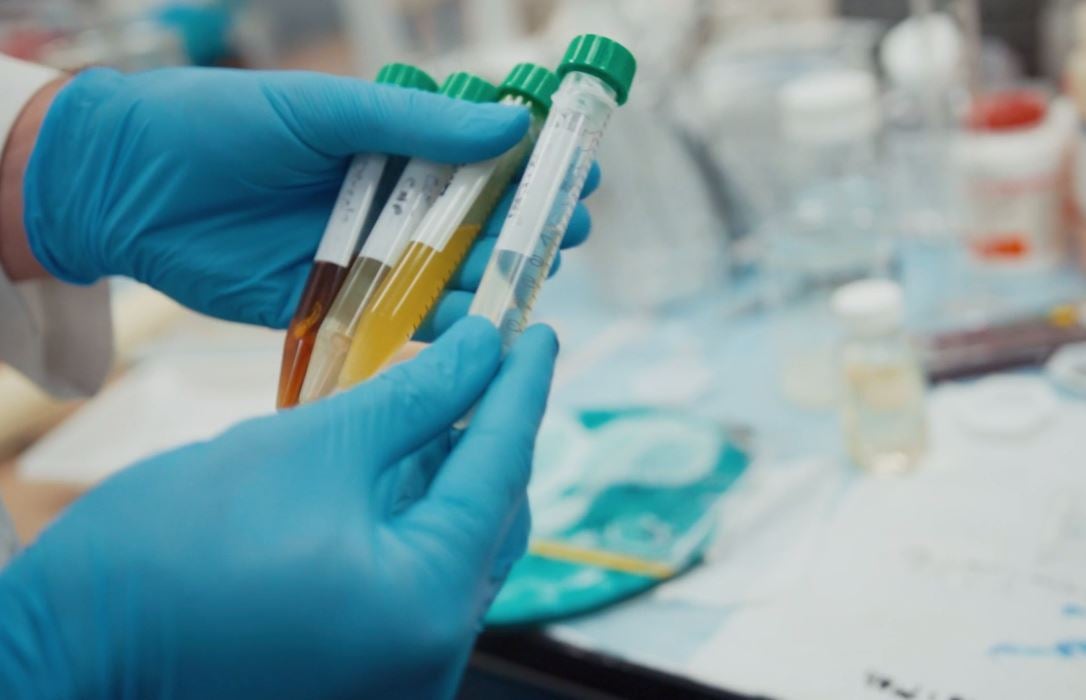 UCF, Nemours Collaborate to Defeat Neuroblastoma Cancer Cells